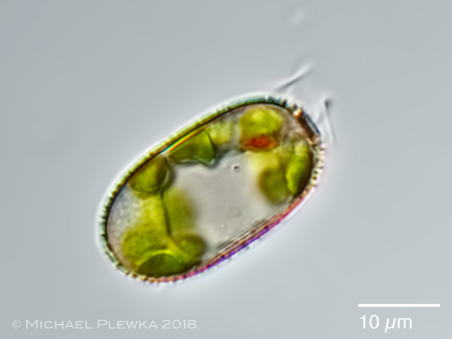 Freshwater and other micro-organisms from Germany: Trachelomonas ellipsoidalis Singh 1956 ...